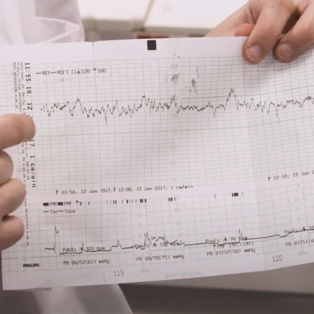 Todo sobre el monitoreo fetal - El blog de Girodmedical
