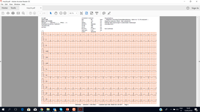 Aplicación de software ECG EasyApp para ECG 100L de Cardioline