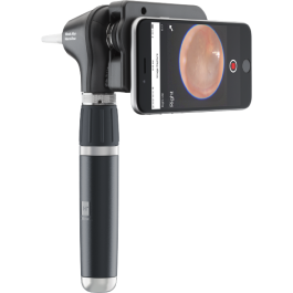 Otoscopio LED MacroView 2 Plus con iExaminer de Welch Allyn