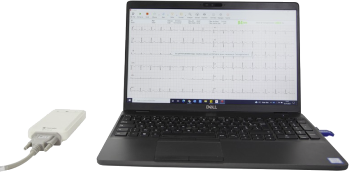 ECG digital Cardiomate PC-ECG de Spengler (12 canales)