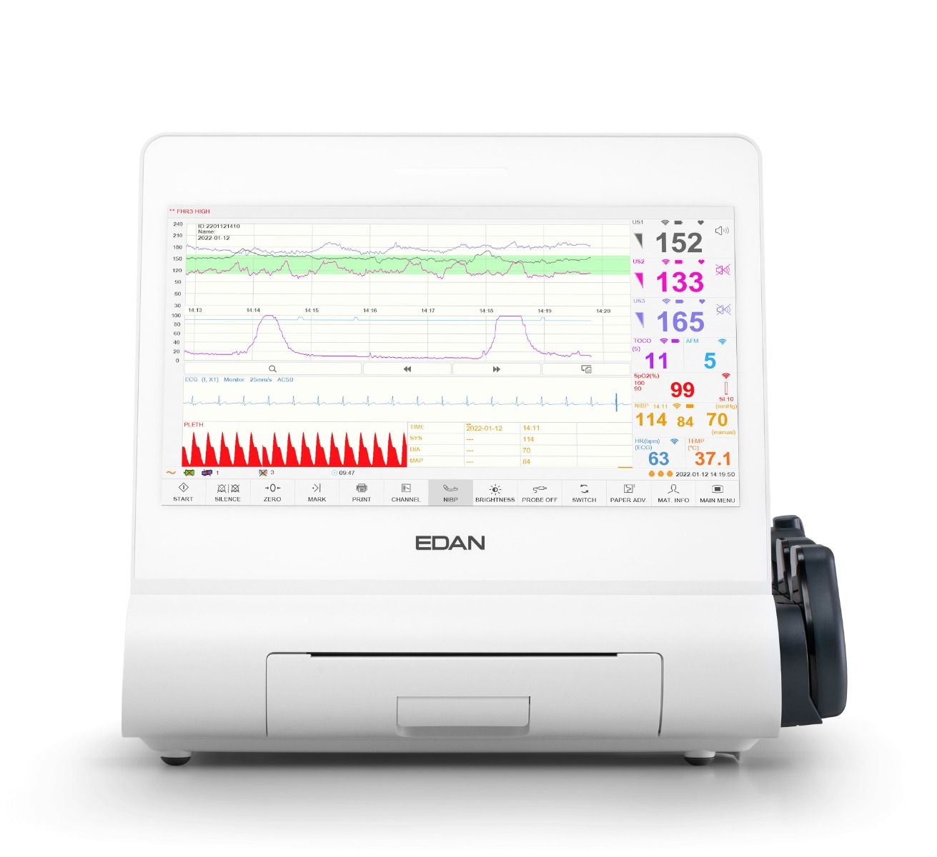 Cardiotocógrafo Monitor fetal Edan F12 con cable + VCT