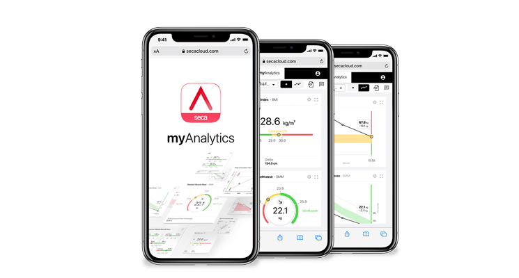 Estación de medición inalámbrica por ultrasonido MBCA 555 - Clase III SECA