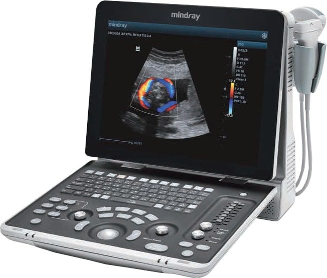 Ecógrafo portátil Mindray Z50 | Girodmedical