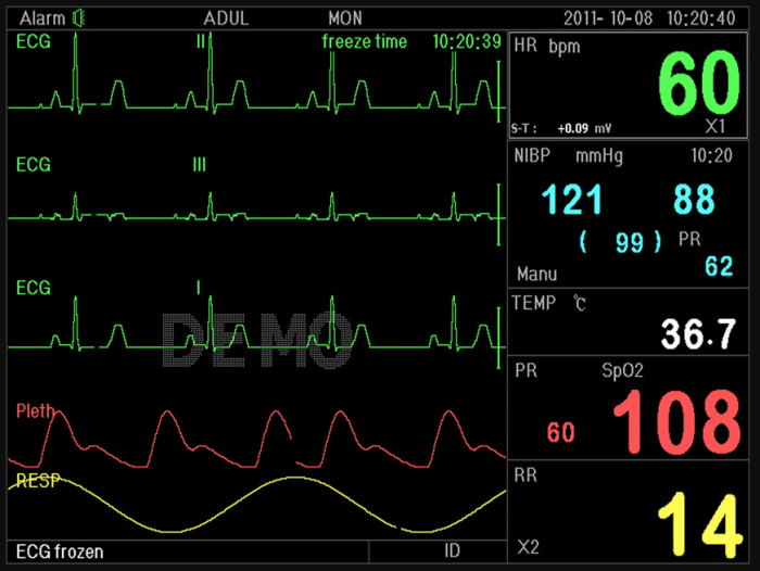 Monitor de paciente multiparamétrico GIMA PC-3000 (TA, SpO2, Temp ...