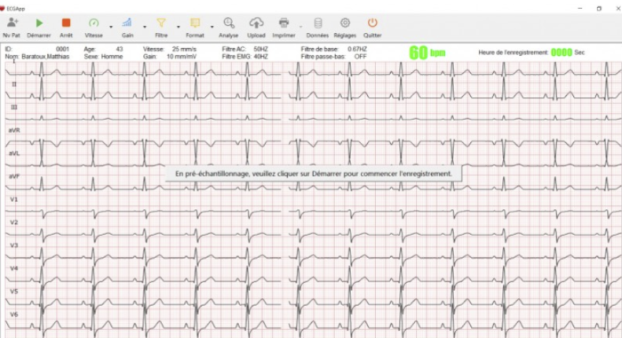 ECG digital Cardiomate PC-ECG de Spengler (12 canales)