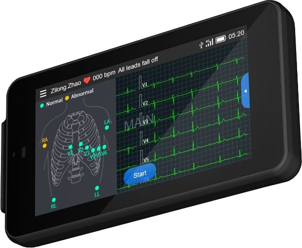 Electrocardiógrafo Portátil Pocket ECG 500 de Lepu Medical con interpretación