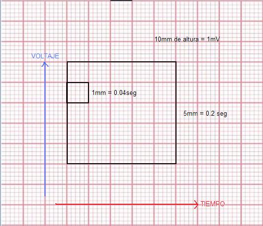 Cómo interpretar un electrocardiograma - El blog de Girodmedical